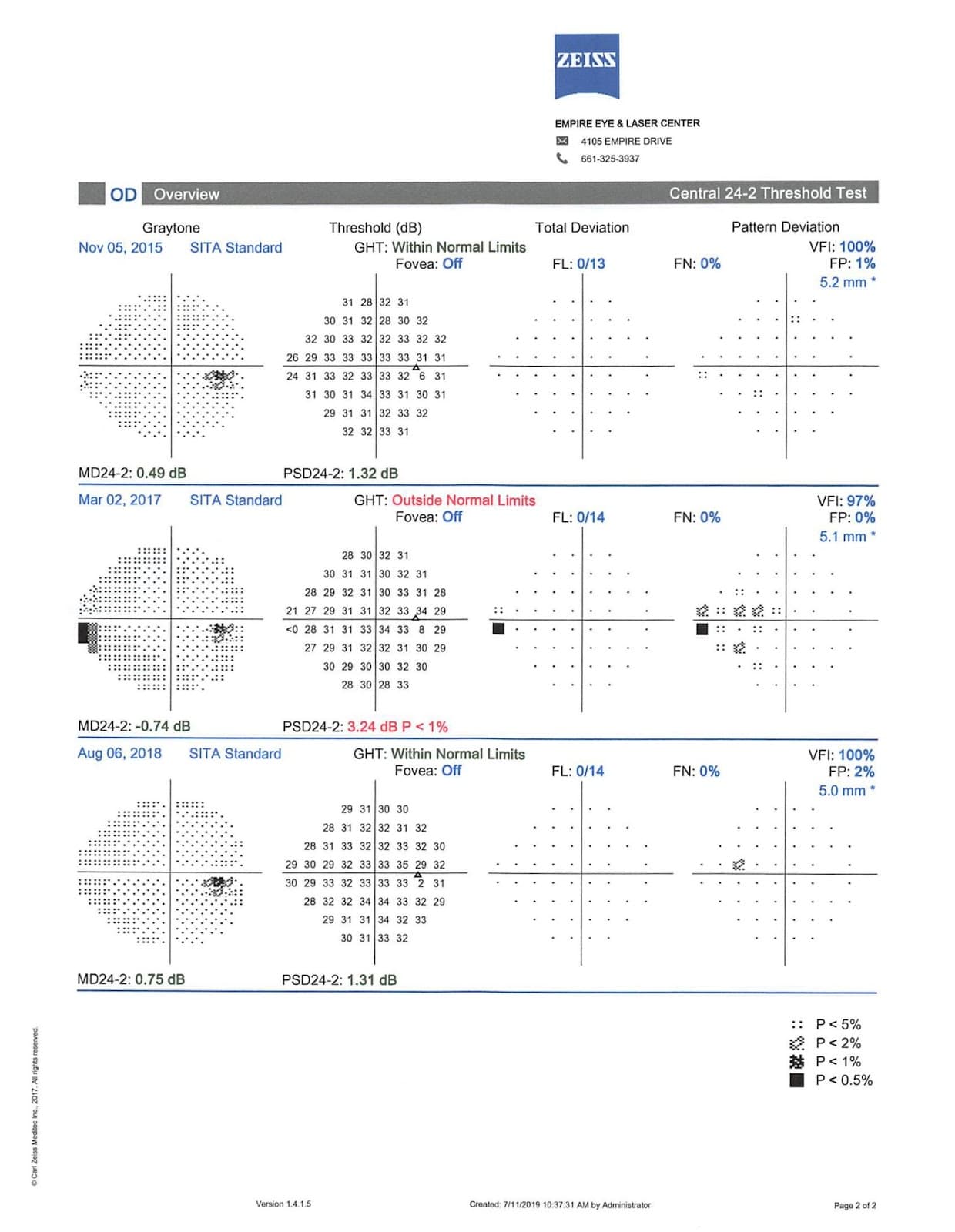 Managing Glaucoma with an Integrated Diagnostic Ecosystem