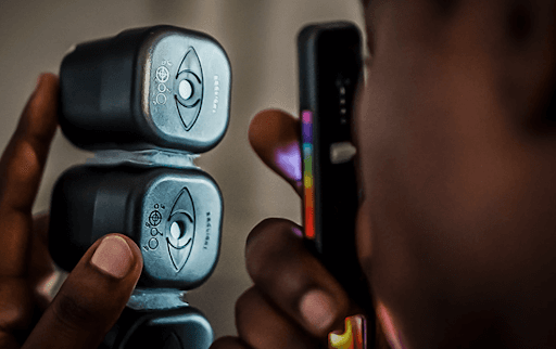 Retinoblastoma: Diagnosing and Treating Pediatric Tumors