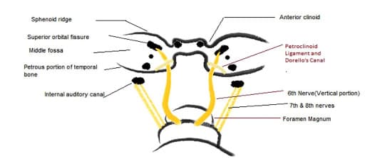 What Every Optometrist Should Know About CN VI Palsy