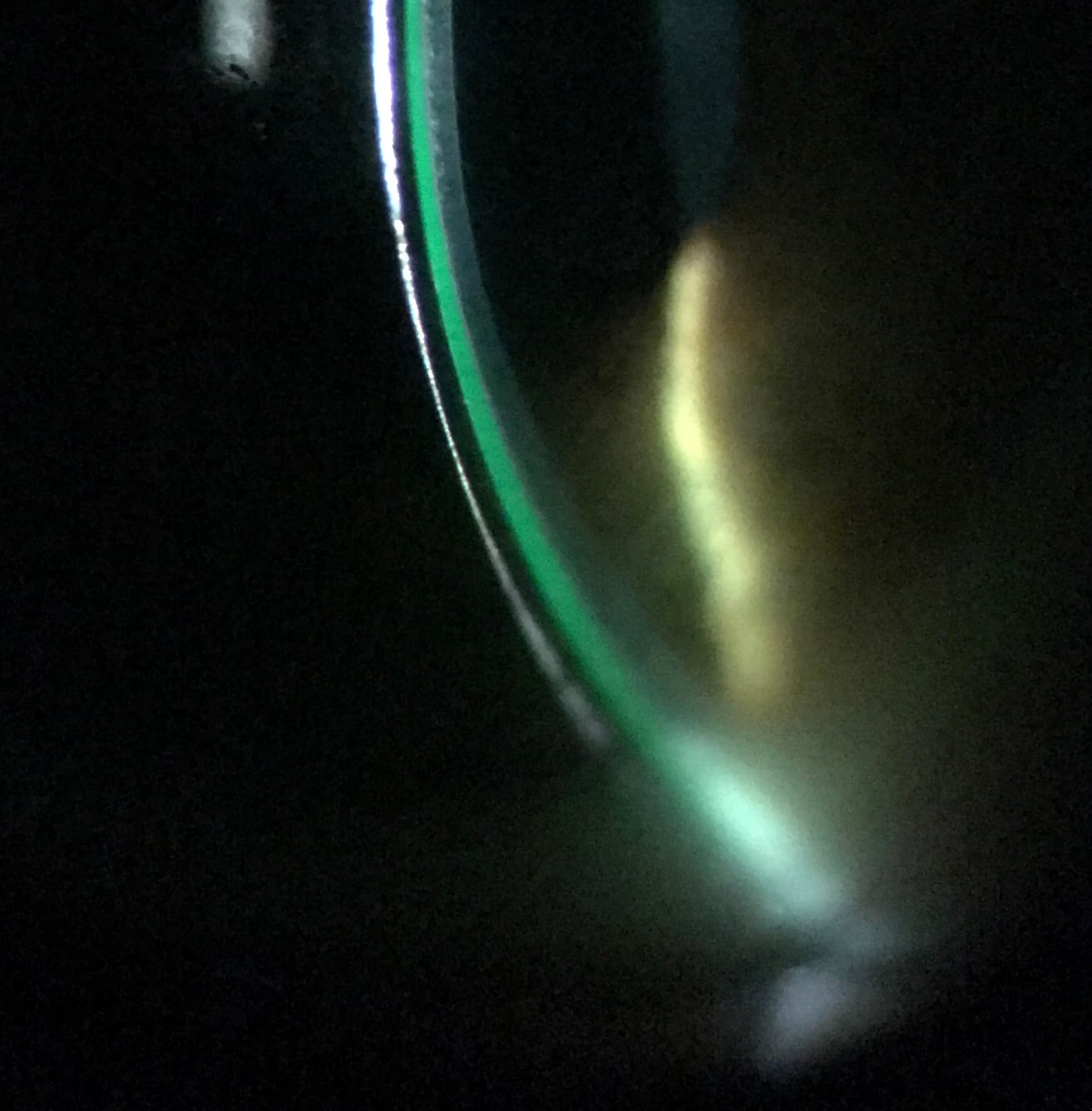 The Ultimate Guide to Scleral Lenses for Dry Eye