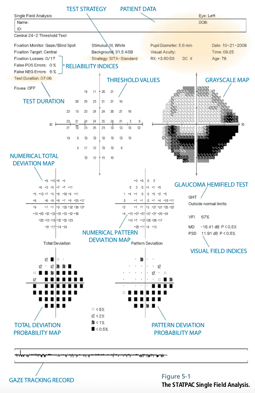 An Optometrist’s Refresher on Visual Field Indices