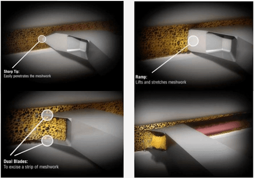 Here’s When and Why I Use Each of These MIGS Devices