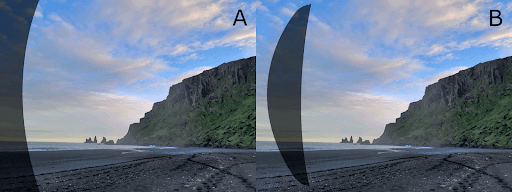 Shedding Light on Positive and Negative Dysphotopsia