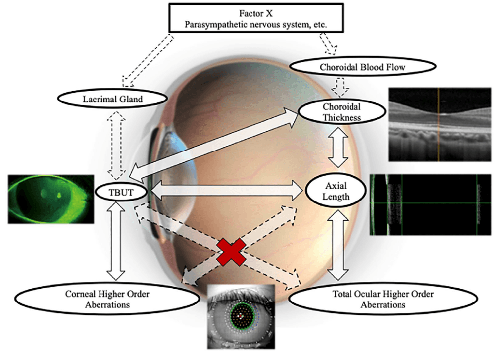 The Link Between Myopia and Dry Eye in Pediatric Patients