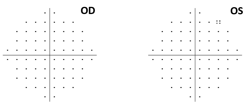 What to Know About Solar Retinopathy