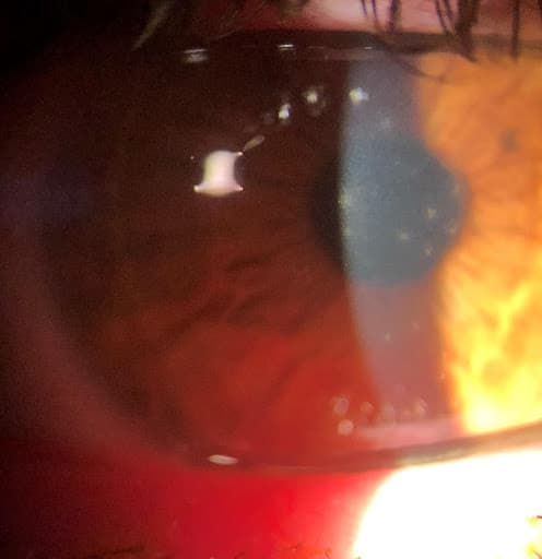 The Ultimate Guide to Conjunctivitis Differential Diagnosis