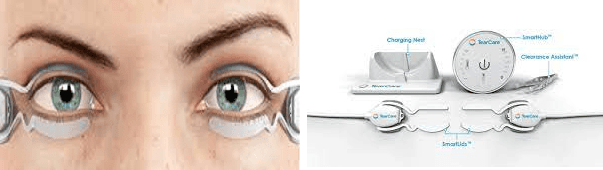 A Comparative Guide to Thermal Pulsation Devices for Dry Eye