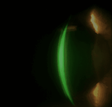 The Complete Guide to SynergEyes Hybrid Contact Lenses