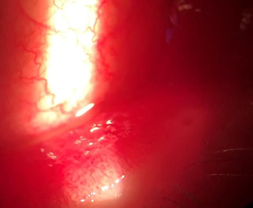 The Ultimate Guide to Conjunctivitis Differential Diagnosis