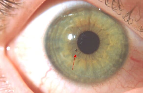 5 Procedures Every Ophthalmology Resident Must Know