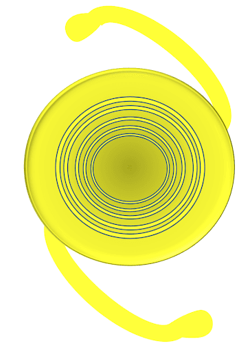 The Ultimate Guide to the Most Commonly Used IOLs