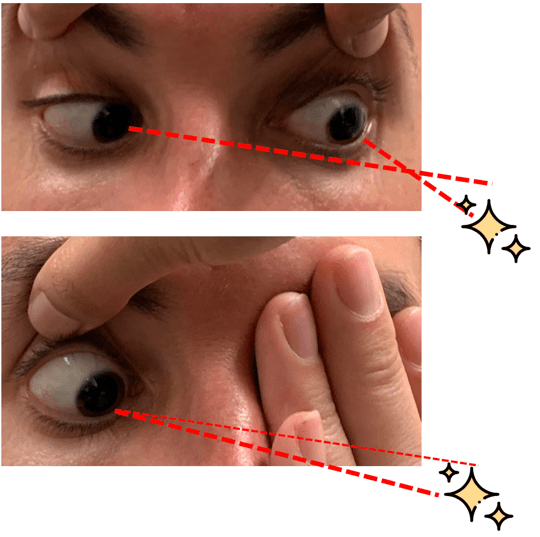 The OD's Practical Approach to Double Vision