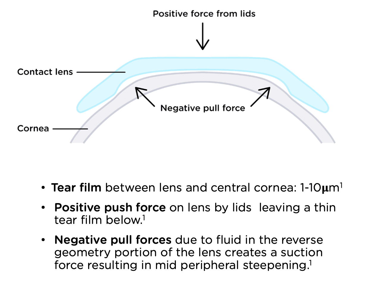 What to Know About ACUVUE® Abiliti™ for Myopia Management