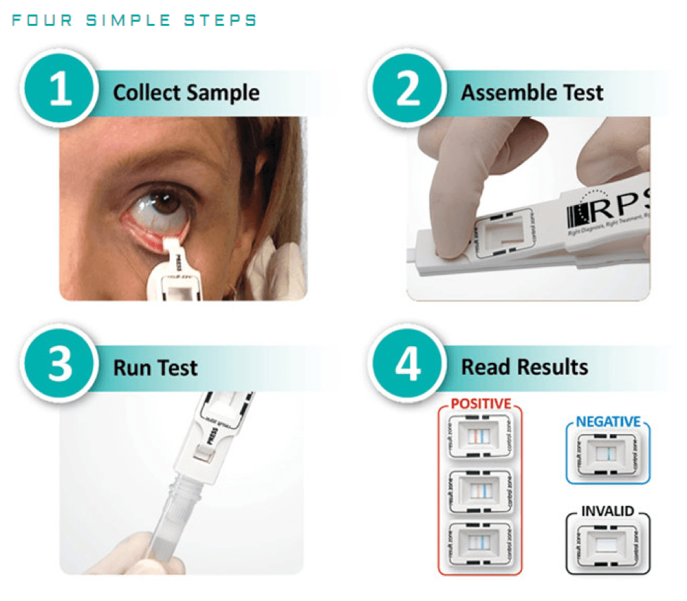 Utilizing TearLab’s Osmolarity System and RPS’s InflammaDry in Dry Eye ...