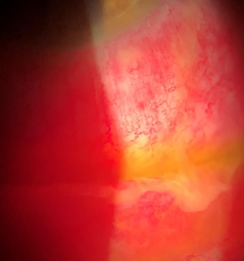 The Ultimate Guide to Conjunctivitis Differential Diagnosis