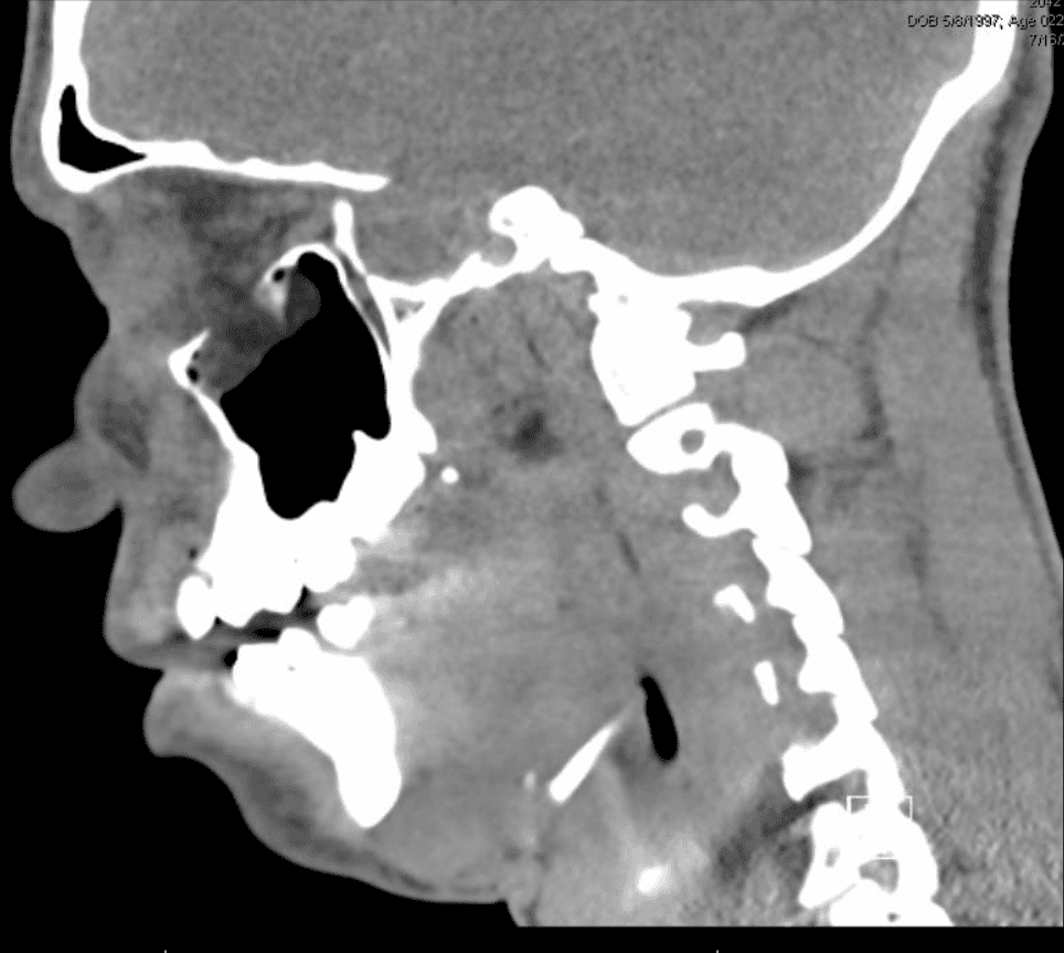Common Eye Emergencies with Differential Diagnosis Cheat Sheet