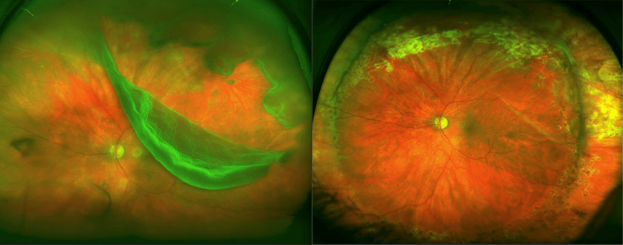 The Ultimate Guide to Retina Fellowship for Ophthalmologists